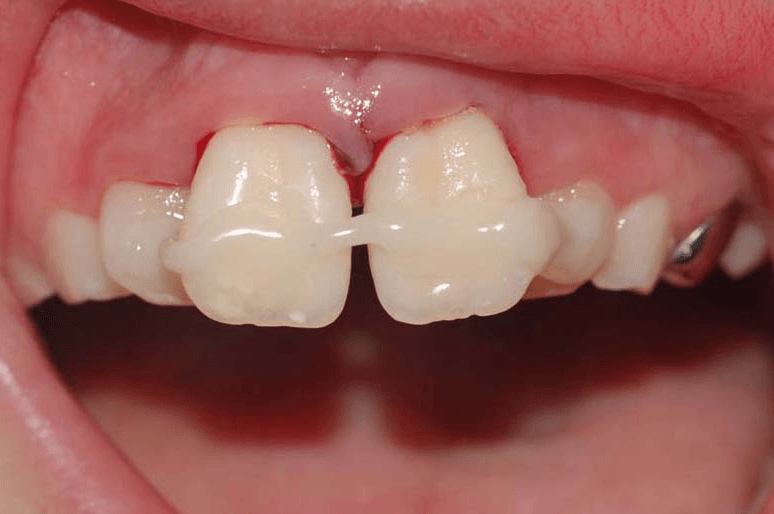 301 Moved Permanently